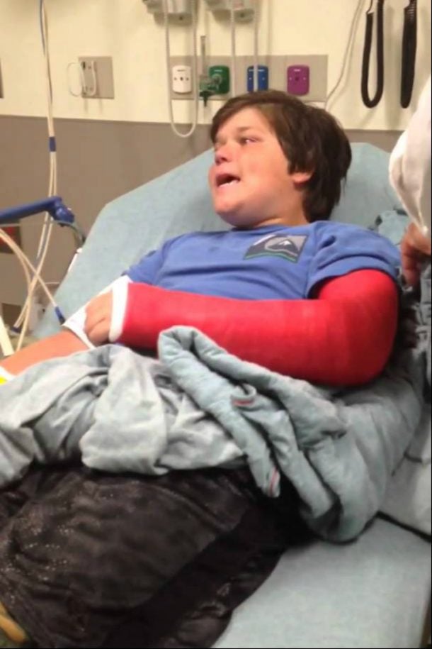 This kid broke his arm, and his reaction to seeing his cast is ...