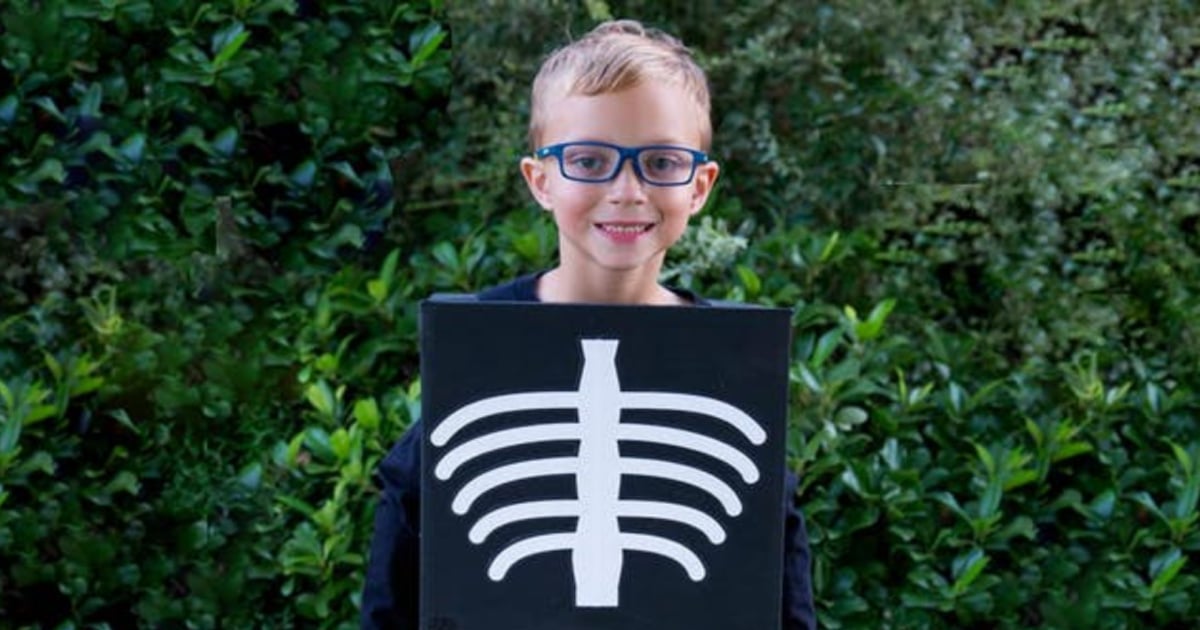 DIY X-Ray Skeleton Costume | Kids Activities Blog