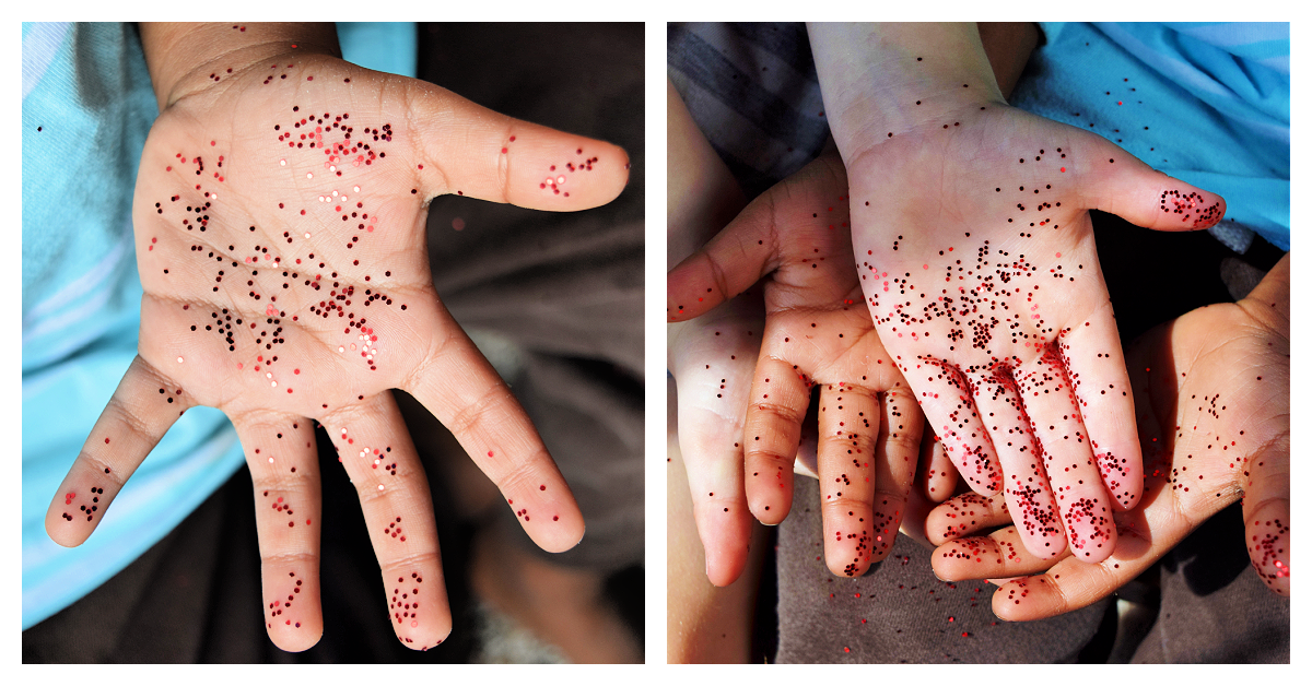 Glitter Hands, Germy Plans! Learn How Germs Spread | Kids Activities Blog